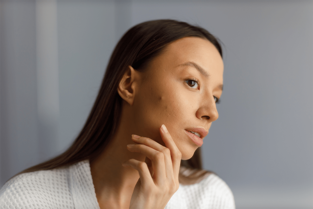 Blemishes and Pigmentation: What’s the Difference? | Forest Essentials